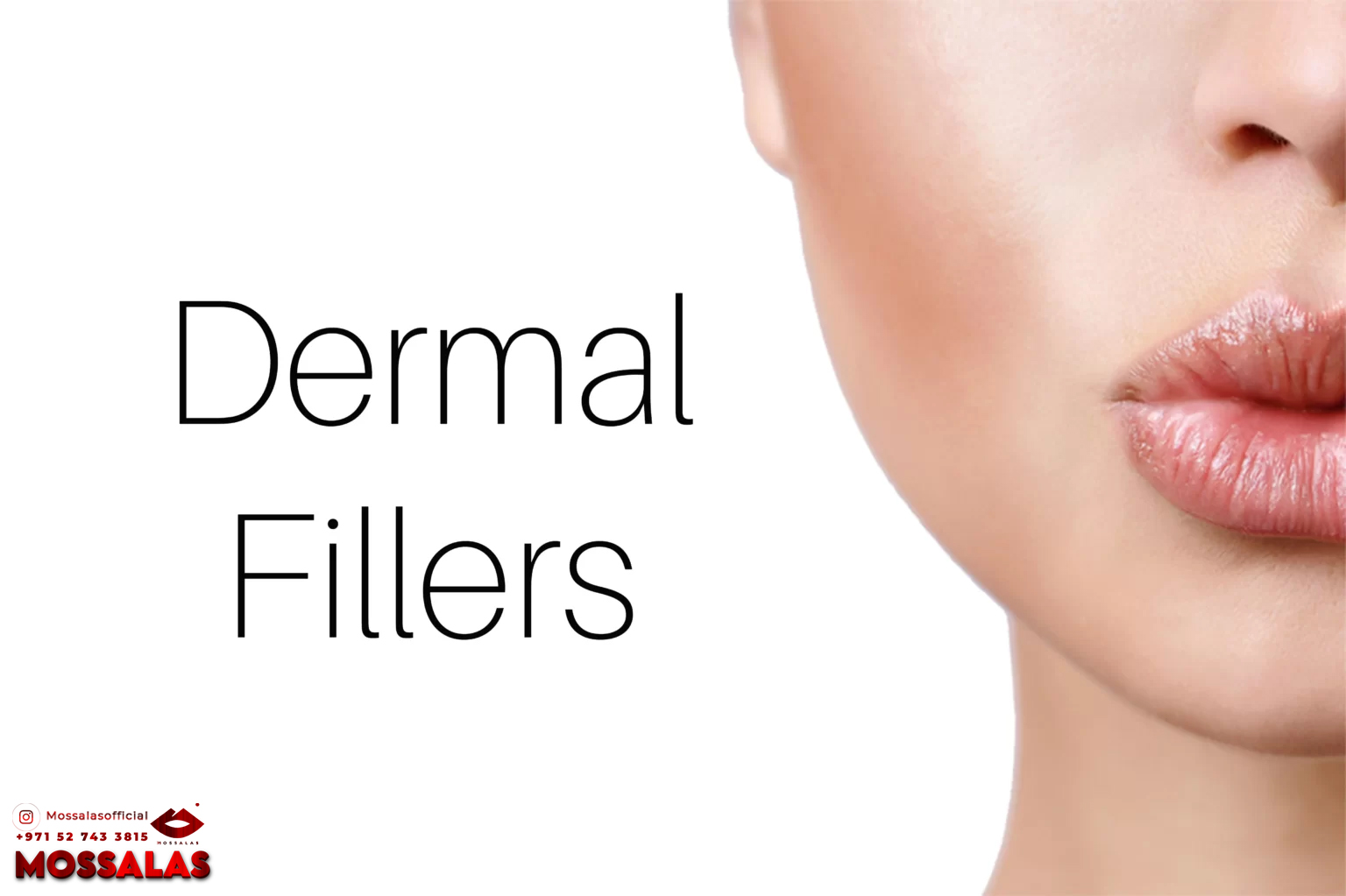 Dermal fillers - mossalas